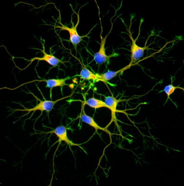 Primary Neurons vs Neuronal Cell Lines - ScienCell Research Laboratories Primary Neurons vs Neuronal Cell Lines - ScienCell Research Laboratories