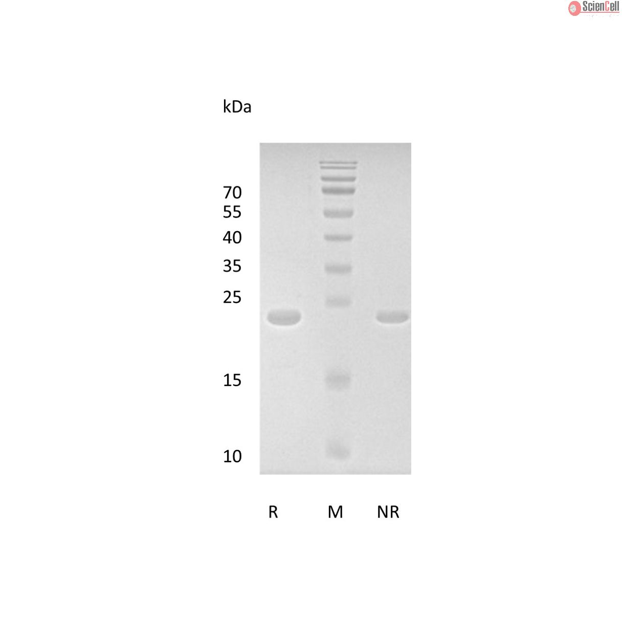 Recombinant Human Fibroblast Growth Factor 8 (rhFGF8)