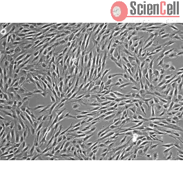 Human Bone Marrow-derived Mesenchymal Stem Cells (HMSC-bm )