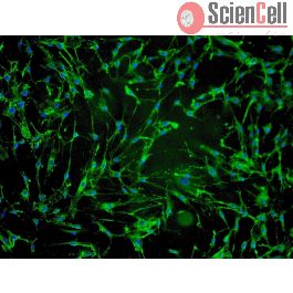 Human Hair Dermal Papilla Cells (HHDPC)