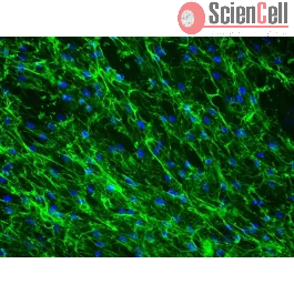 Human Lymphatic Fibroblasts (HLF)