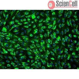 Human Mammary Vascular Endothelial Cells (HMVEC)