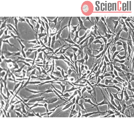 Human Synoviocytes (HS )