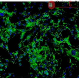 Human Thyroid Fibroblasts (HThF)