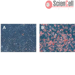Lipid Accumulation/ Steatosis Colorimetric Assay Kit (SCA)