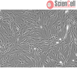 Rat Pulmonary Artery Smooth Muscle Cells (RPASMC)