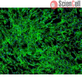 Human Hair Inner Root Sheath Cells (HHIRSC)