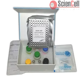 Human IL-2 ELISA Kit (hIL-2-ELISA )