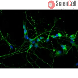 Rat Neurons-midbrain (RN-mb)