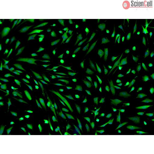 Human Induced Pluripotent Stem Cell-derived Astrocytes (HiPSC-A)
