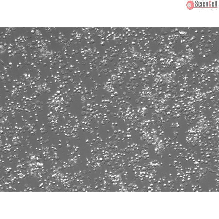 Rat Bone Marrow Mononuclear Cells (RBMMC)