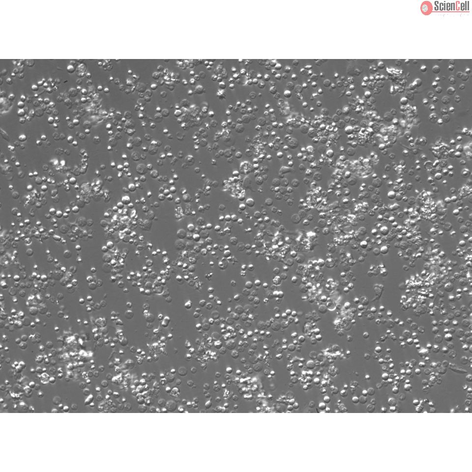 Rat Bone Marrow Mononuclear Cells (RBMMC)