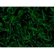 Mouse Astrocytes from CD1 (MA)