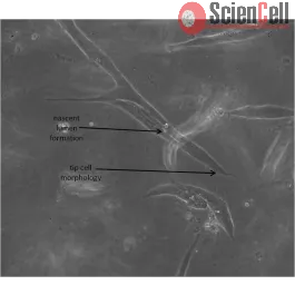 3D Embedded Tubule Formation Kit (3D-ETF)
