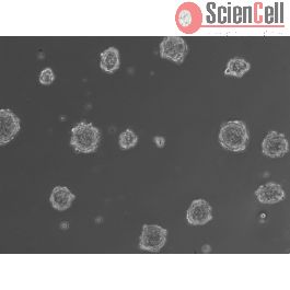 3D Human Hepatic Stellate Cell Monoculture Spheroid Formation