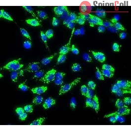 Human Aortic Endothelial Cells (HAEC)