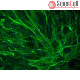 Human Bladder Smooth Muscle Cells (HBdSMC)