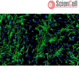 Human Cardiac Fibroblasts-ventricular (HCF-av)