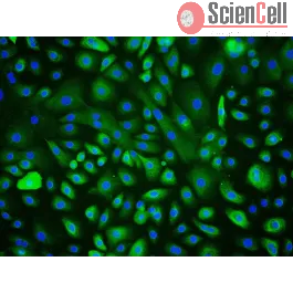 Human Corneal Epithelial Cells (HCEpiC)