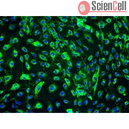 Human Dermal Lymphatic Endothelial Cells (HDLEC)