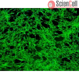 Human Gingival Fibroblasts (HGnF)