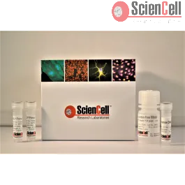 Human Global DNA Methylation Quantification qPCR Assay Kit (HGDM)