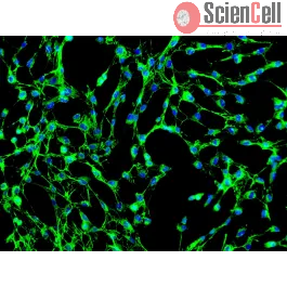 Human Pulmonary Fibroblasts (HPF)