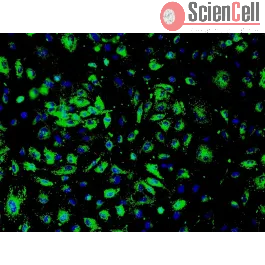Human Renal Glomerular Endothelial Cells (HRGEC)