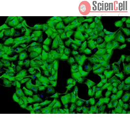 Human Seminal Vesicle Epithelial Cells (HSVEpiC)