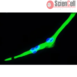 Human Skeletal Muscle Cells (HSkMC)