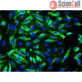 Human Splenic Endothelial Cells (HSEC )