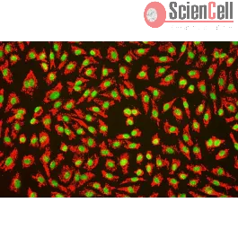 Human Umbilical Vein Endothelial Cells (HUVEC)