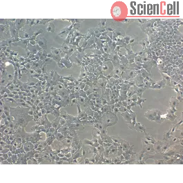 Mouse Lens Epithelial Cells (MLEpiC)