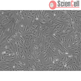 Mouse Pulmonary Fibroblasts from C57BL/6 (MPF)
