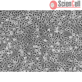 Rat Renal Proximal Tubular Epithelial Cells (RRPTEpiC)