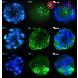 Ready-to-use 3D Hepatic Stellate-Endothelial Cell Spheroids...
