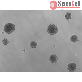 Ready-to-use 3D Human Trabecular Meshwork Cell Spheroids (SP3D-HTMCS)