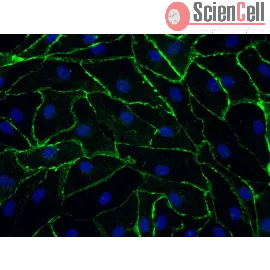 Human Rectal Microvascular Endothelial Cells (HRecMEC) | Sciencell...